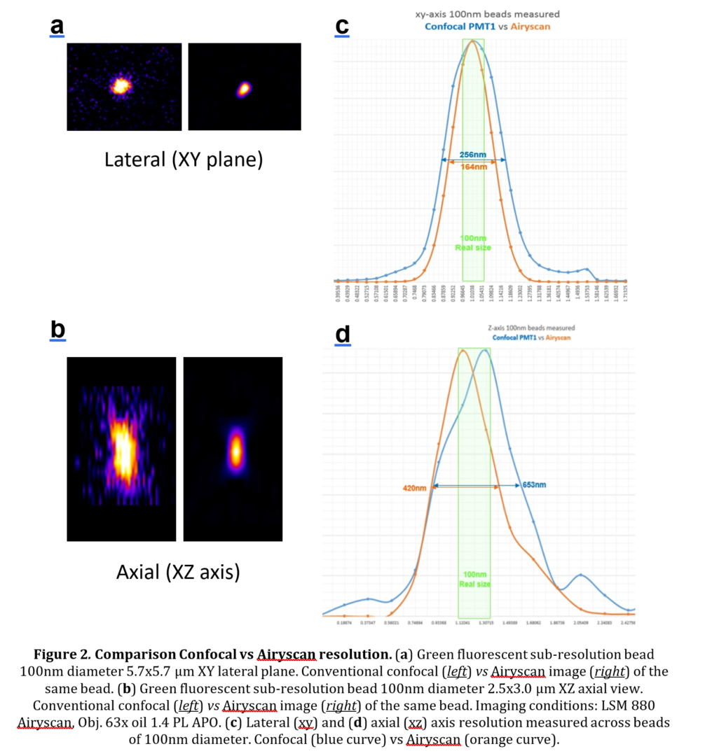 The Airyscan system for improved confocal resolution – Cellular Imaging ...